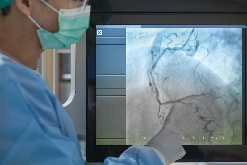 Biopsie: diagnostic rapid si precis | Memorial
