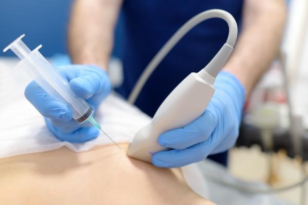 Biopsie: diagnostic rapid si precis | Memorial
